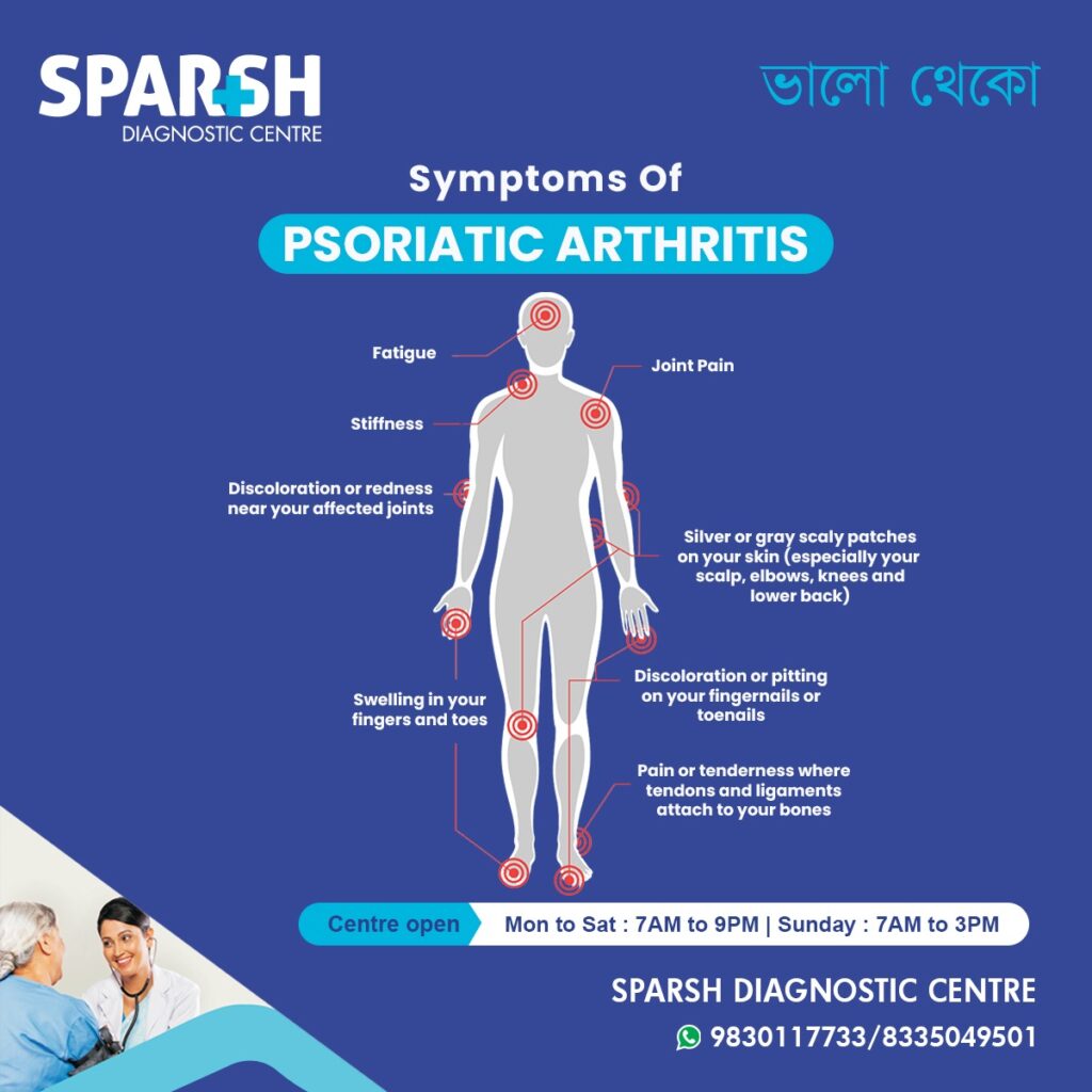 Psoriatic Arthritis Symptoms Diagnosis And Treatment Sparsh 8045