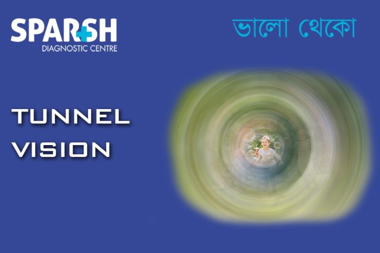 Tunnel Vision: Causes, Symptoms, Diagnosis, and Treatment - Sparsh ...