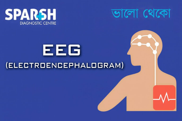 EEG (Electroencephalogram): A Complete Guide to the Brain-Wave Test ...