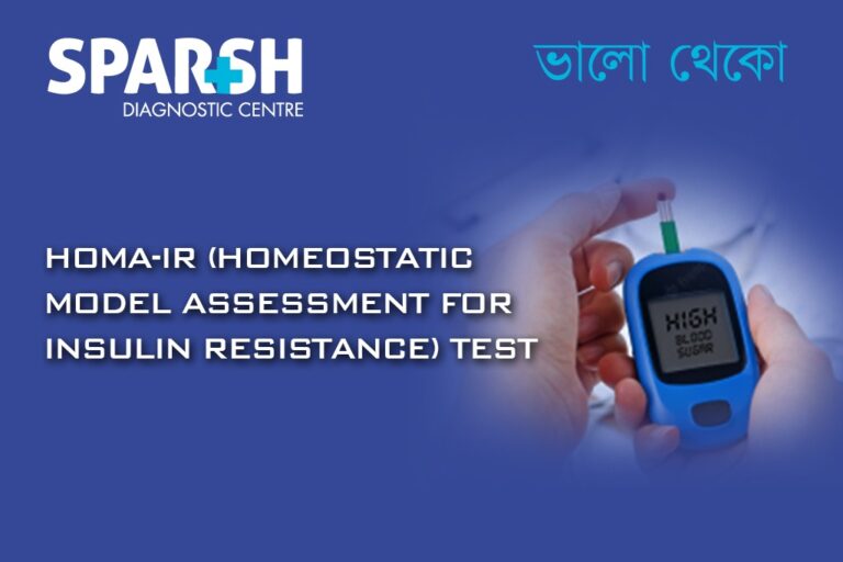 HOMA-IR (Homeostatic Model Assessment for Insulin Resistance) Test ...