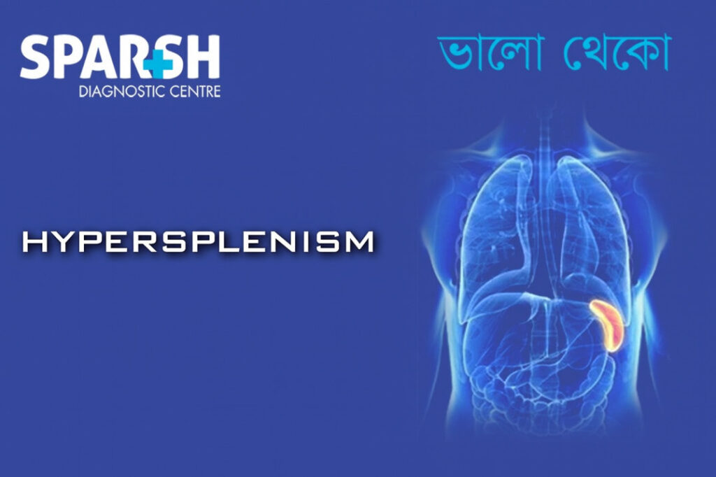 Hypersplenism: Symptoms, Causes, Diagnosis, Treatment, and Prevention ...