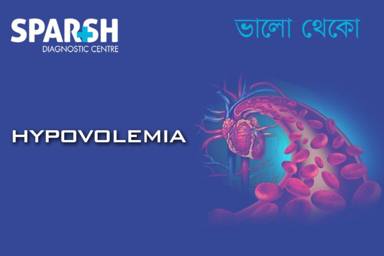 Hypovolemia: Causes, Symptoms, Diagnosis & Treatment – A Complete Guide ...