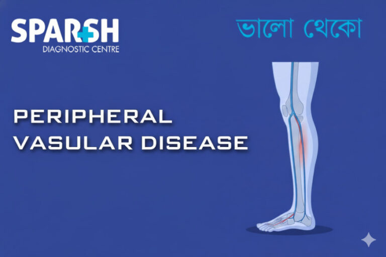 Peripheral Vascular Disease (PVD): Causes, Symptoms, Diagnosis, and ...