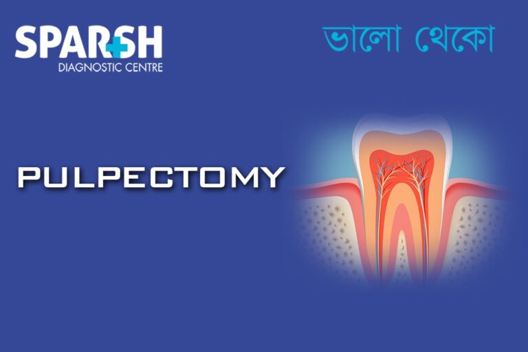 Pulpectomy: Procedure, Benefits, Recovery & Complete Guide - Sparsh ...