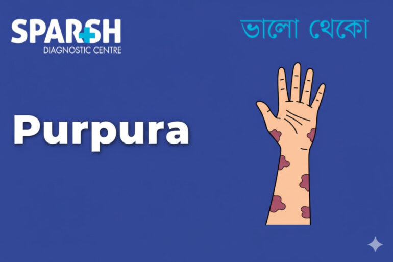 Purpura: Causes, Symptoms, Diagnosis, Treatment & Prevention - Sparsh ...
