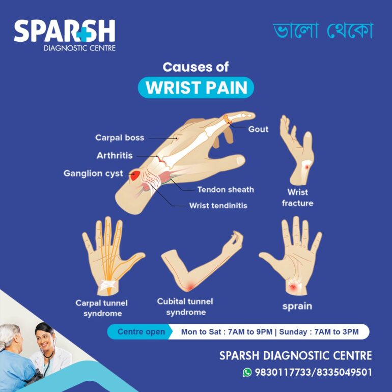 Wrist Pain: Causes, Symptoms, Diagnosis, Treatment & Prevention ...