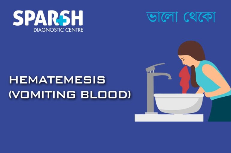 Hematemesis (Vomiting Blood): Causes, Symptoms, Diagnosis, and ...