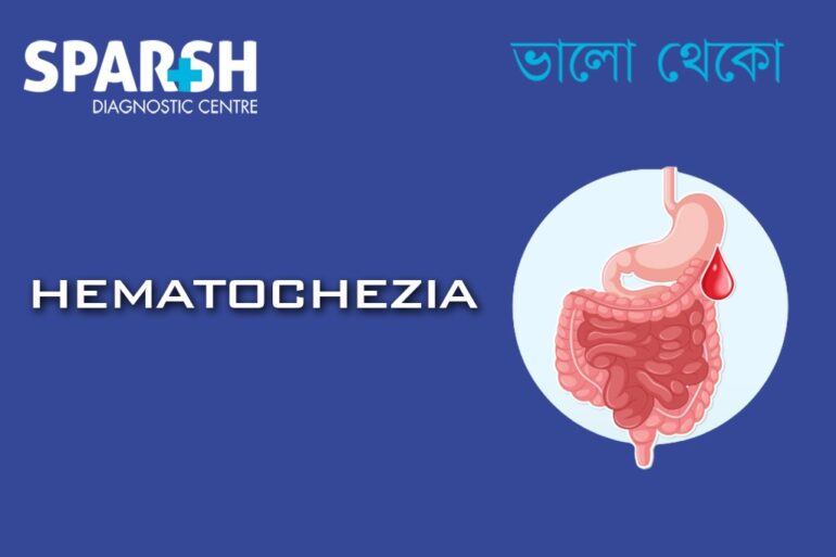 Hematochezia: Causes, Symptoms, Diagnosis, and Treatment Explained ...
