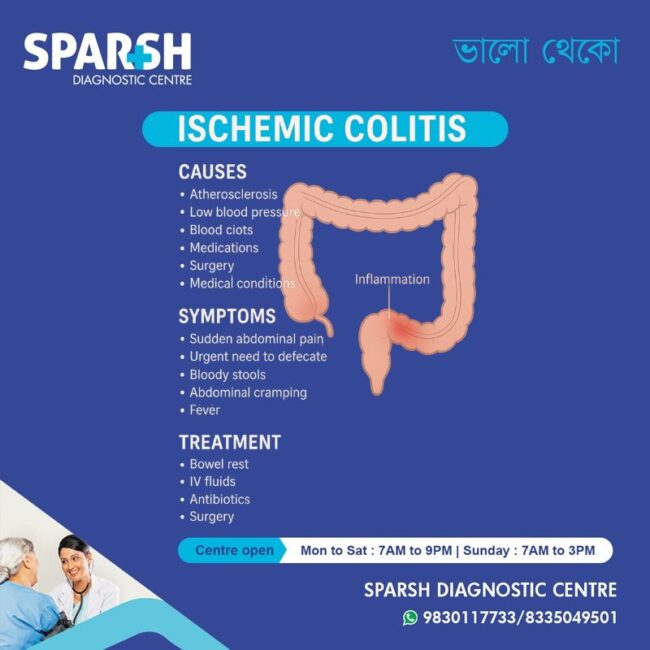 Ischemic Colitis: Causes, Symptoms, Diagnosis, and Treatment - Sparsh ...