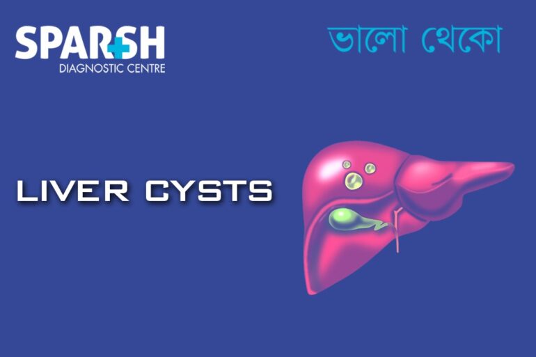 Liver Cysts: Causes, Symptoms, Diagnosis, Treatment & Complications ...