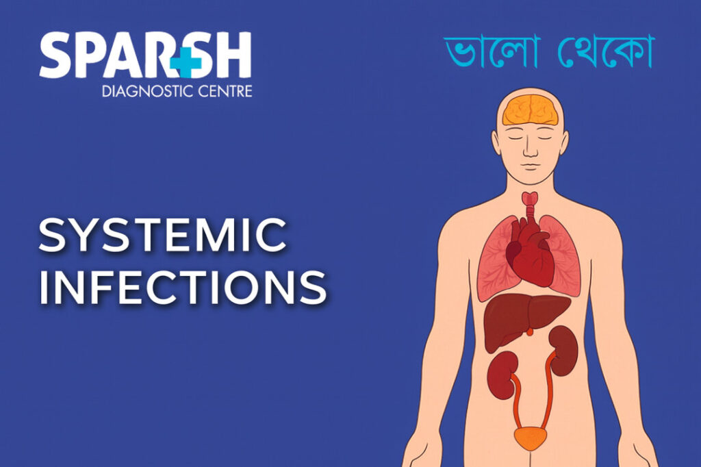 Systemic Infections: Causes, Symptoms, Diagnosis, and Treatment ...