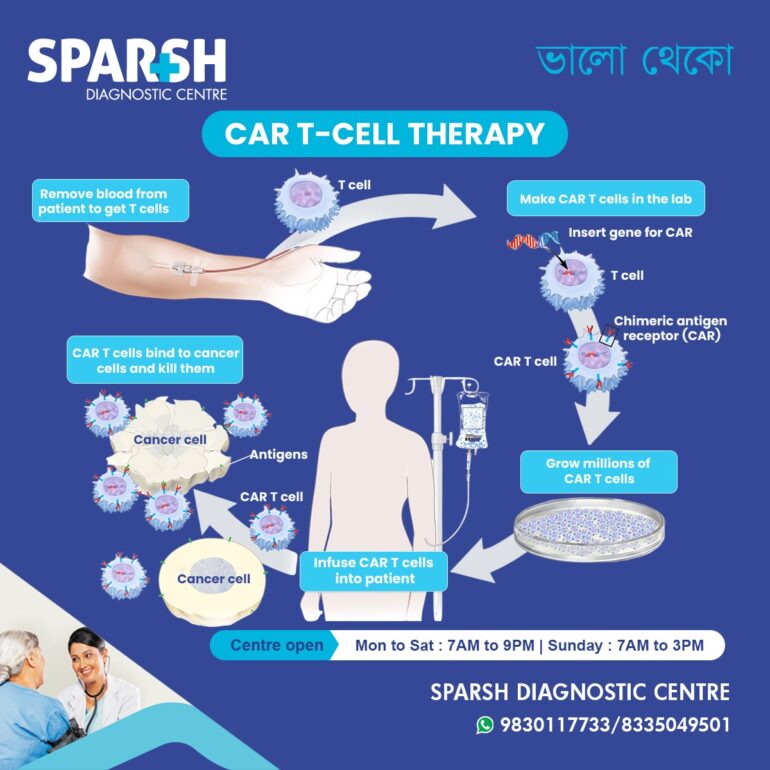 CAR T-Cell Therapy: A Breakthrough in Cancer Treatment - Sparsh ...