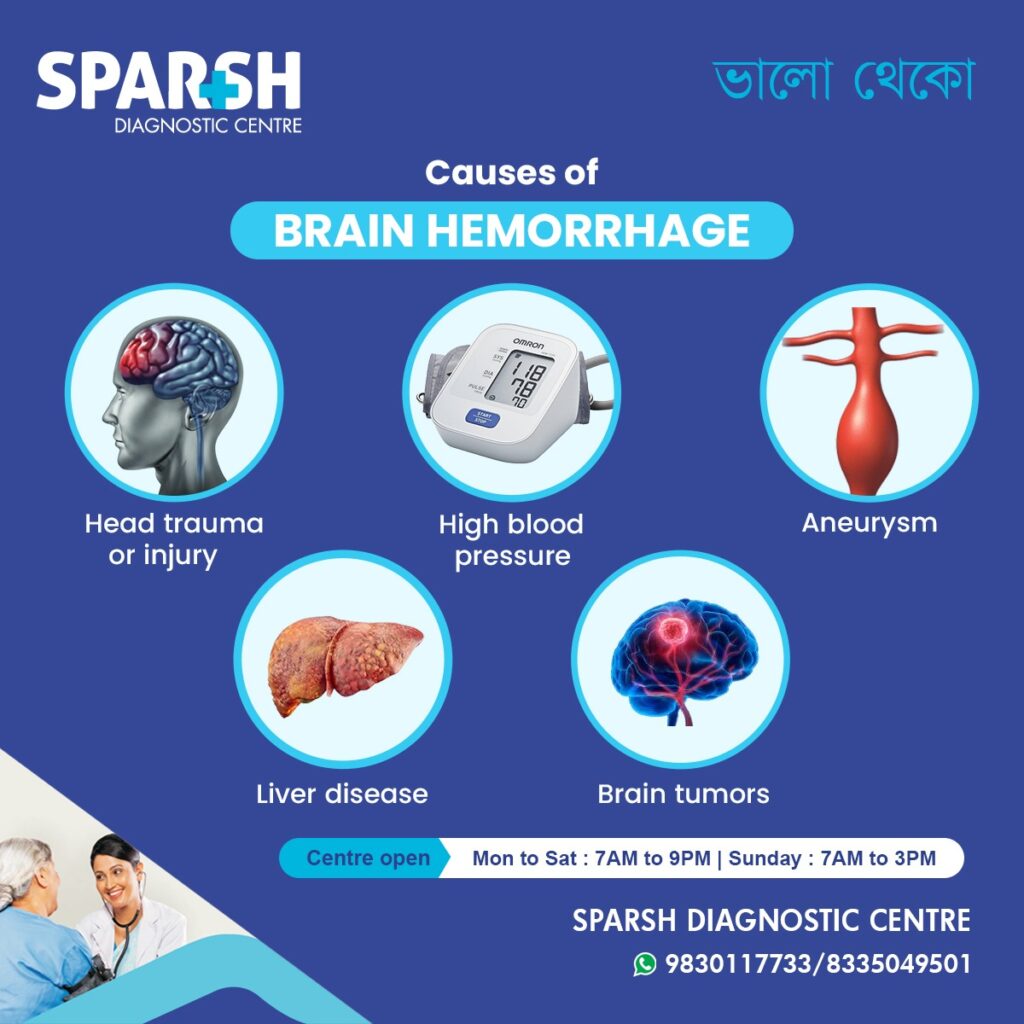 Brain Hemorrhage: Causes, Symptoms, Diagnosis, Treatment, and Recovery ...
