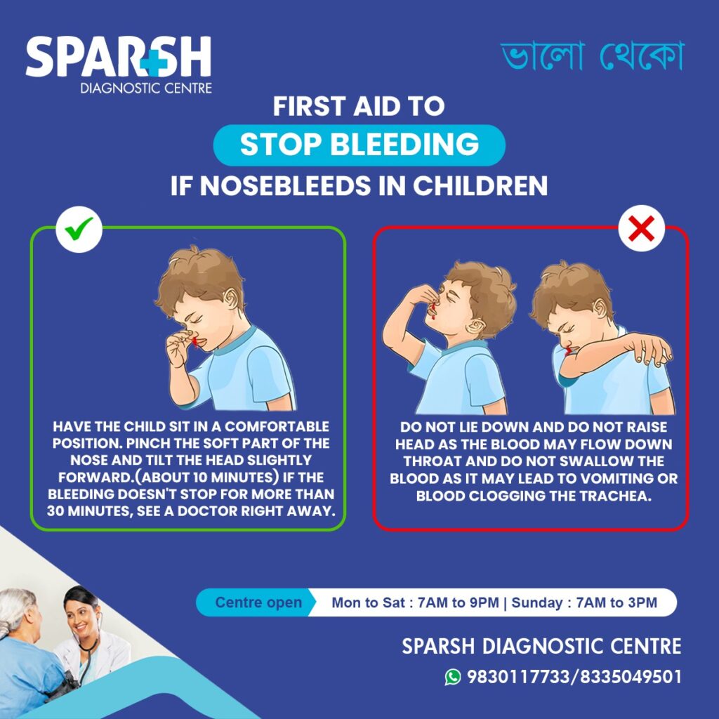 Nosebleeds In Children: Causes, First Aid and Prevention - Sparsh ...