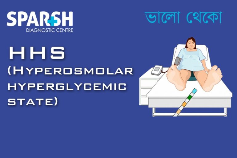 Hyperosmolar Hyperglycemic State (HHS): Causes, Symptoms, Diagnosis ...