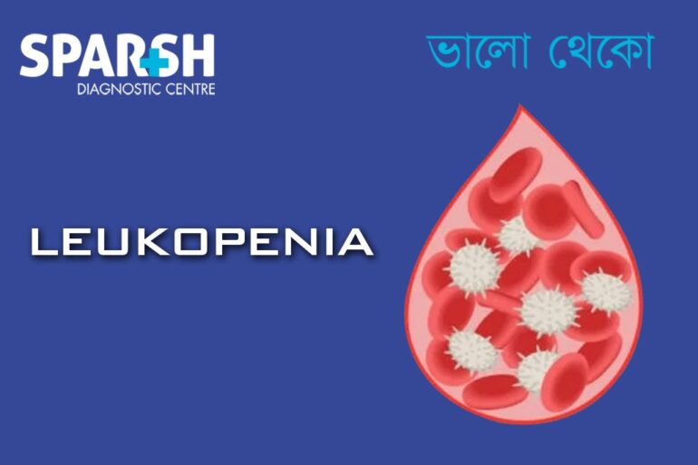 Leukopenia: Causes, Types, Symptoms, Diagnosis, and Treatment - Sparsh ...