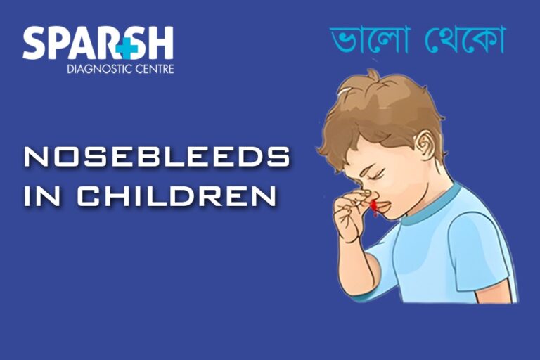 Nosebleeds In Children: Causes, First Aid and Prevention - Sparsh ...