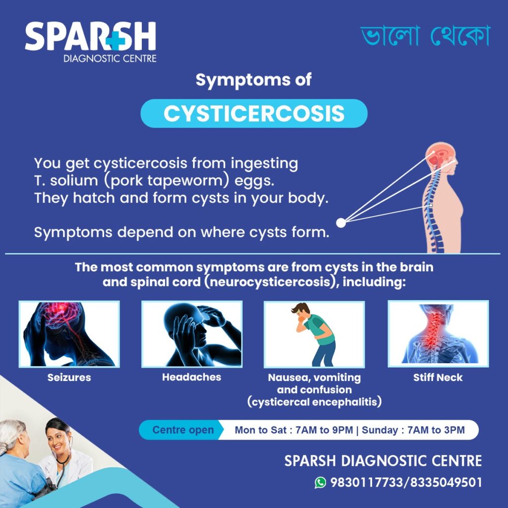 Cysticercosis: Causes, Symptoms, Diagnosis, Treatment, and Prevention ...