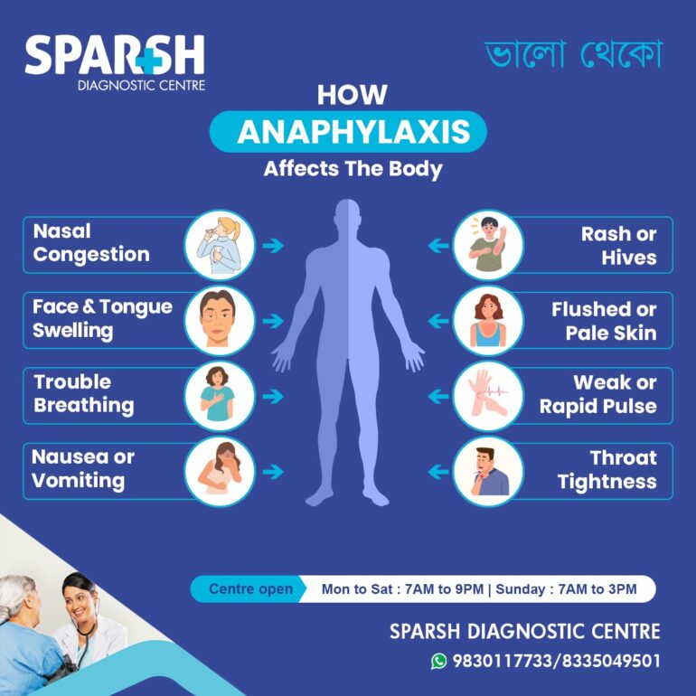 Anaphylaxis: Causes, Symptoms, Emergency Treatment, and Prevention ...