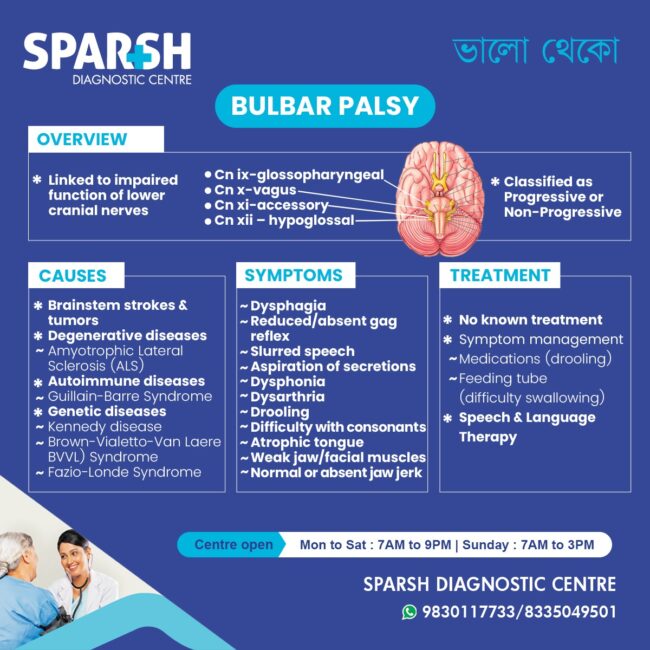 Bulbar Palsy: Causes, Symptoms, Diagnosis, and Treatment Explained ...