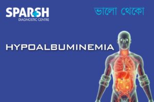 Hypoalbuminemia: Causes, Symptoms, Diagnosis, and Treatment - Sparsh ...