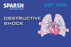 Obstructive Shock: Causes, Symptoms, Diagnosis, and Emergency ...