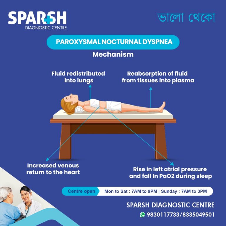 Paroxysmal Nocturnal Dyspnea: Causes, Symptoms, Mechanism & Treatment ...
