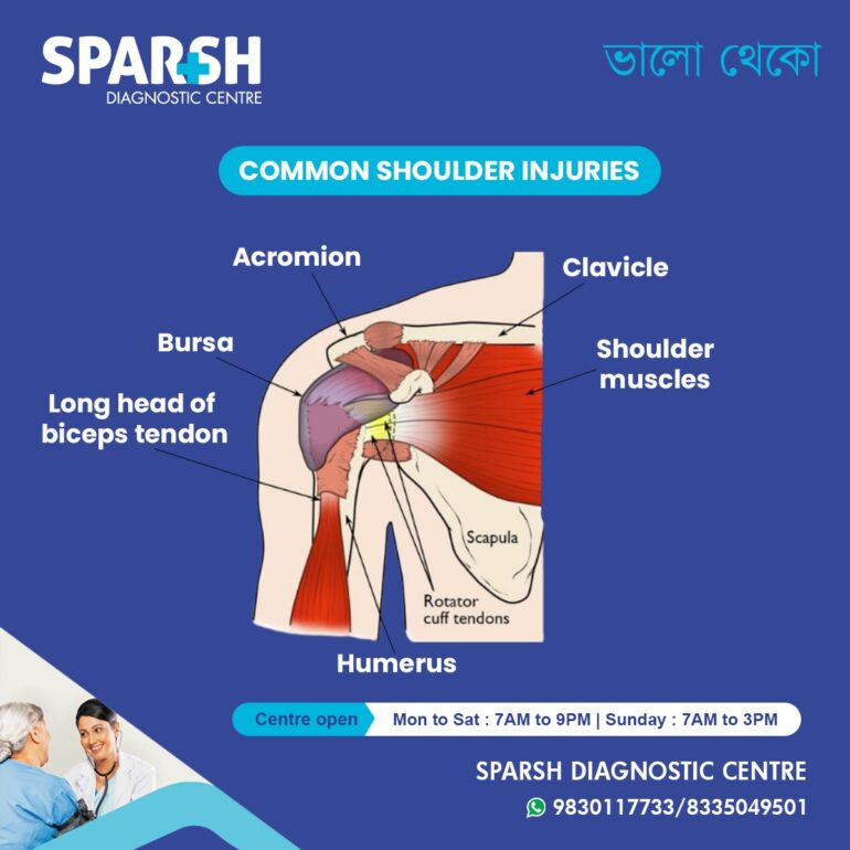 Shoulder Injuries: Causes, Symptoms, Treatment, and Prevention - Sparsh ...