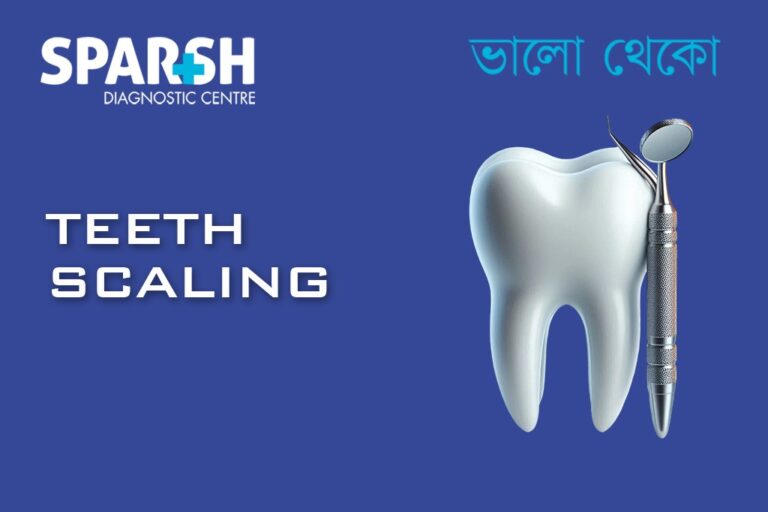 Teeth Scaling: Why It Matters for a Healthier, Brighter Smile - Sparsh ...