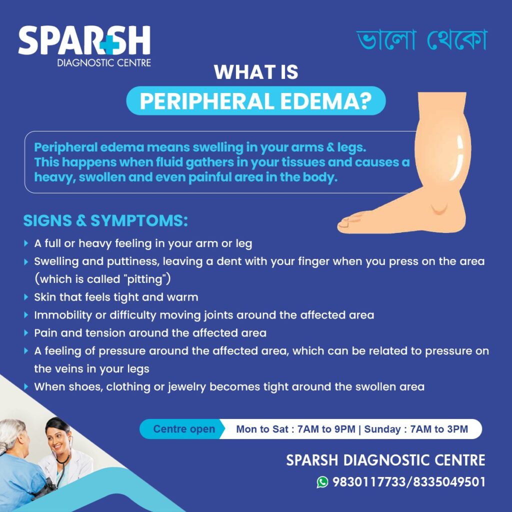 Peripheral Edema: Causes, Symptoms, Treatment & When to Worry - Sparsh ...