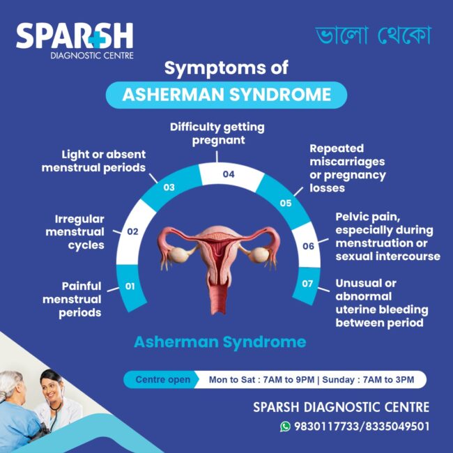 Asherman Syndrome: Causes, Symptoms, Diagnosis, and Treatment - Sparsh ...