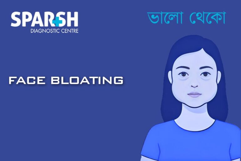 Face Bloating: Causes and Remedies - Sparsh Diagnostic Center