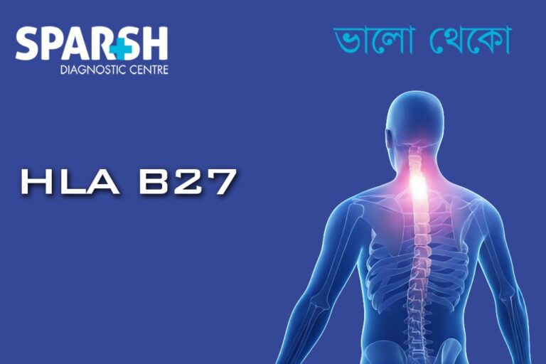 HLA-B27: What It Means, Why It Matters, and When to Get Tested - Sparsh ...