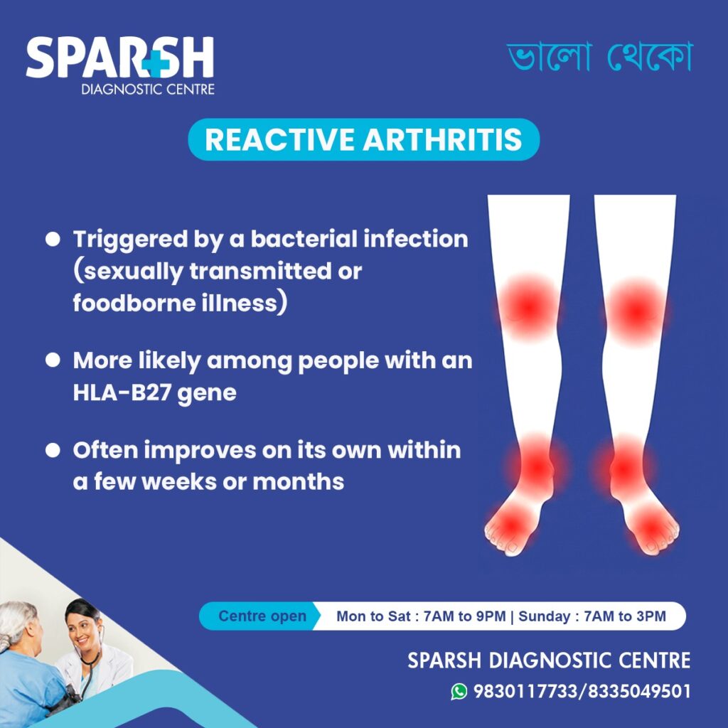 Reactive Arthritis: Causes, Symptoms, Diagnosis, Treatment, and ...